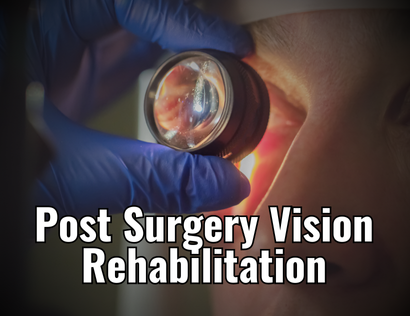 Post Surgery Vision Rehabilitation: The Role of Physiotherapy in Eye ...